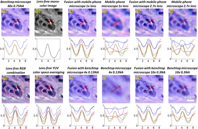 Color calibration and fusion of lens-free and mobile-phone microscopy ...