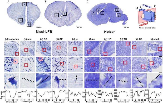 Label-free, multi-scale imaging of ex-vivo mouse brain using spatial ...