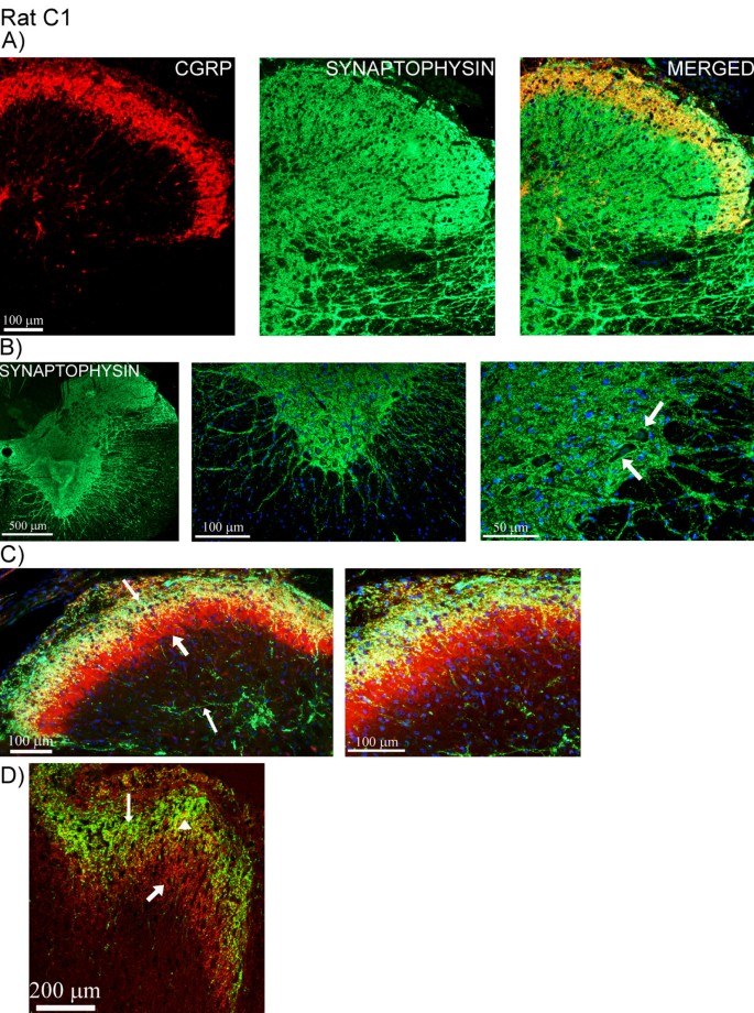 Calcitonin gene-related peptide (CGRP) and its receptor components in ...