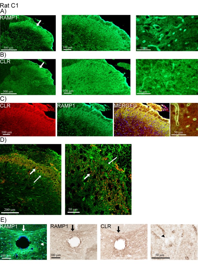 Calcitonin gene-related peptide (CGRP) and its receptor components in ...