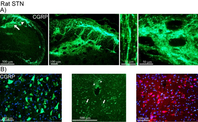 Calcitonin gene-related peptide (CGRP) and its receptor components in ...