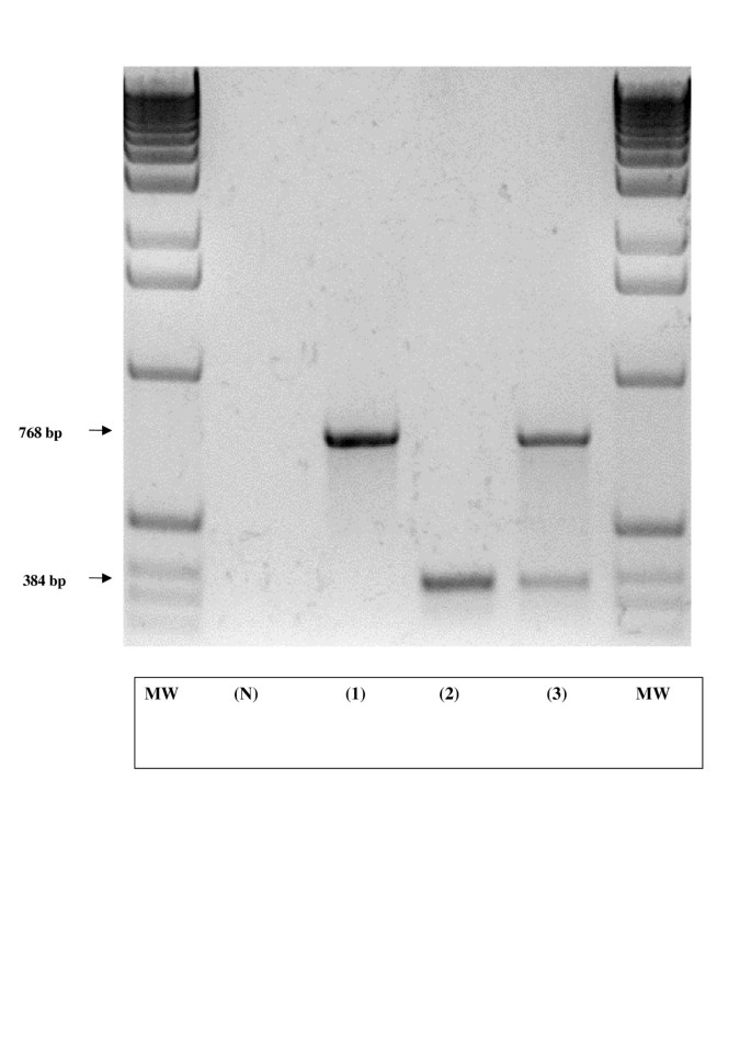 Short description of an alternative simplified method for screening ...