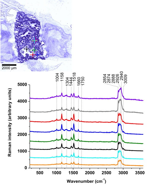 Raman imaging at biological interfaces: applications in breast cancer ...