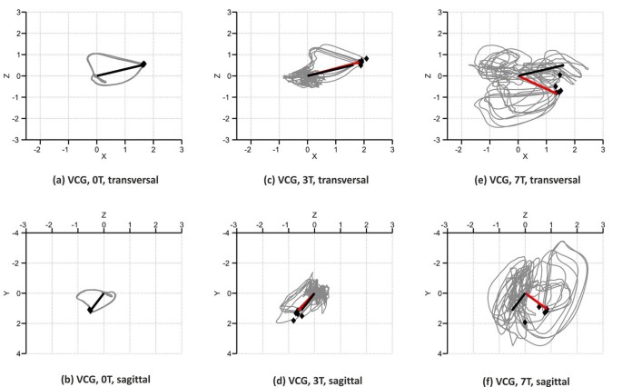 Limitations of VCG based gating methods in ultra high field cardiac MRI ...