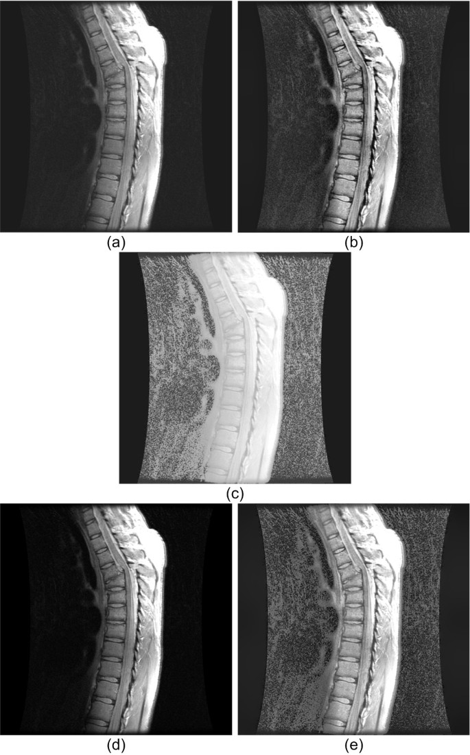 Image fusion-based contrast enhancement | EURASIP Journal on Image and ...
