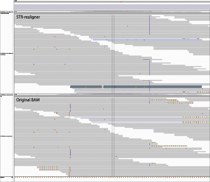 STR-realigner: a realignment method for short tandem repeat regions ...