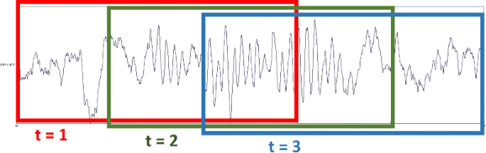 Detecting epileptic seizures with electroencephalogram via a context ...