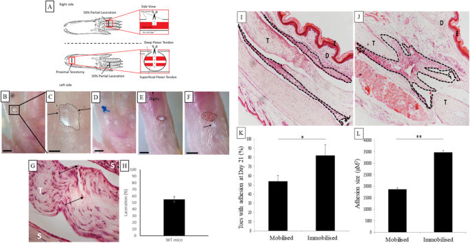 Increasing the level of cytoskeletal protein Flightless I reduces ...