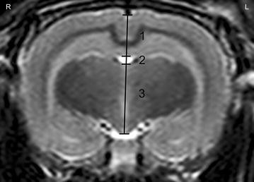 Magnetic resonance imaging anatomy of the rabbit brain at 3 T ...