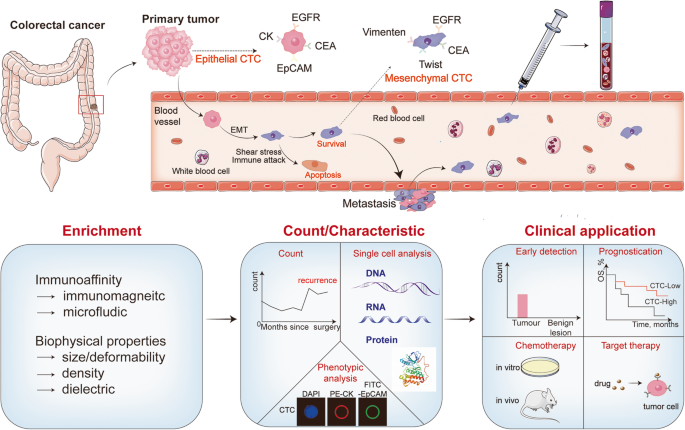 Detection and clinical significance of circulating tumor cells in ...