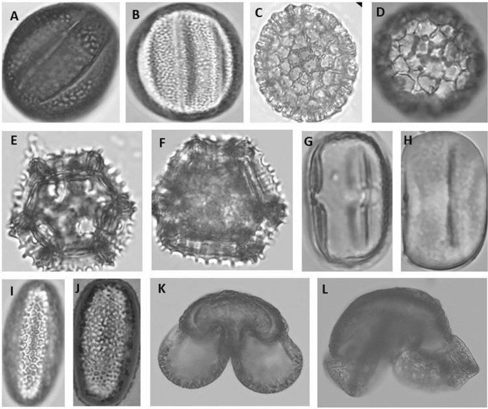 Efficient pollen grain classification using pre-trained Convolutional Neural Networks: a ...