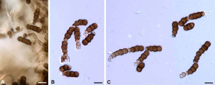Studies in genera similar to Torula: Bahusaganda, Bahusandhika ...