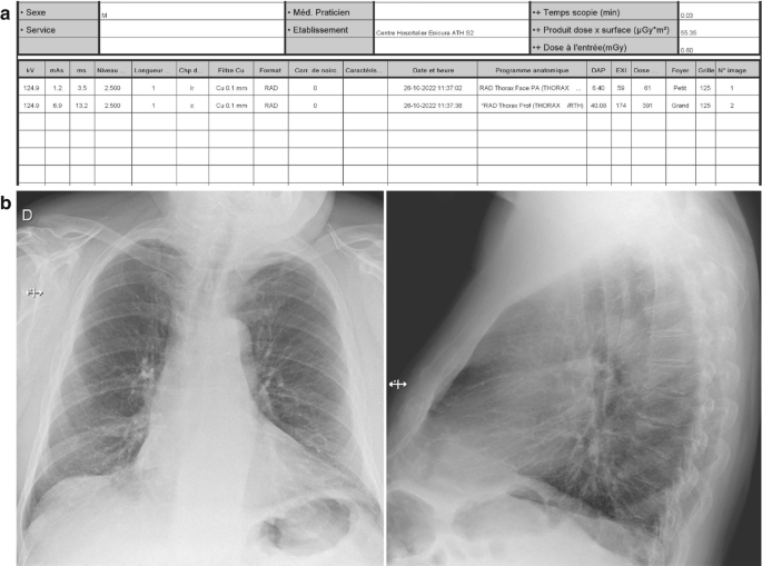 Radiation Dose | SpringerLink