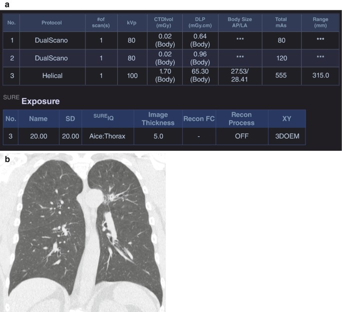 Radiation Dose | SpringerLink