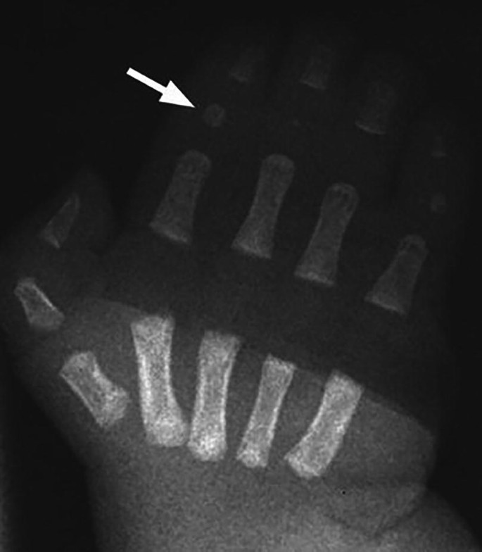 Congenital and Developmental Abnormalities | SpringerLink