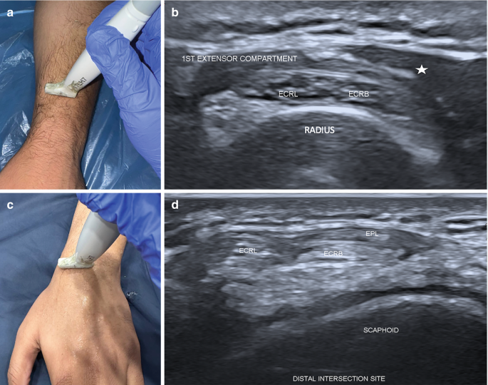 Ultrasound Imaging Techniques and Procedures | SpringerLink