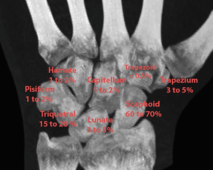 Computed Tomography of Hand and Wrist | SpringerLink