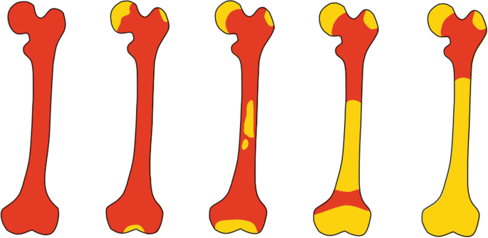 Imaging of Age-Related Physiological Changes of the Bone Marrow ...
