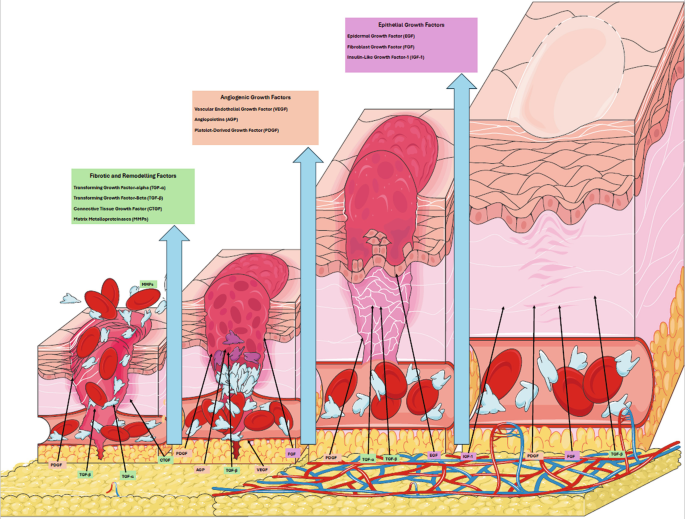 Transformative Therapies for Wound Care: Insights into Tissue ...
