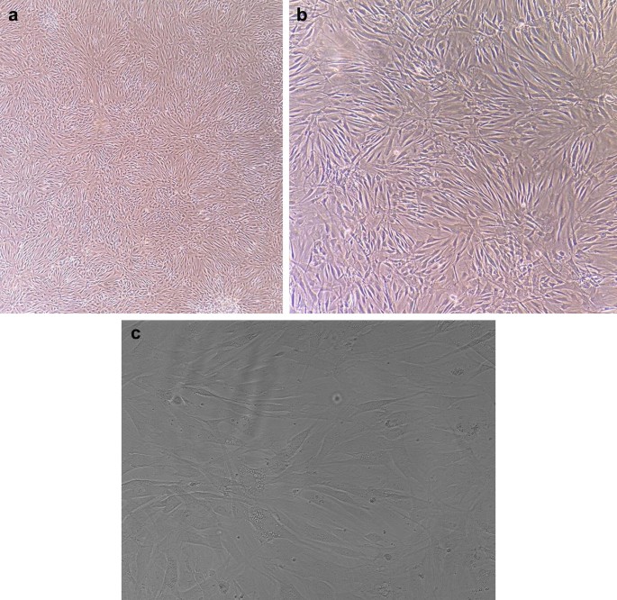 Upstream Process Protocol for MSCs Isolated from Different Human-Based ...