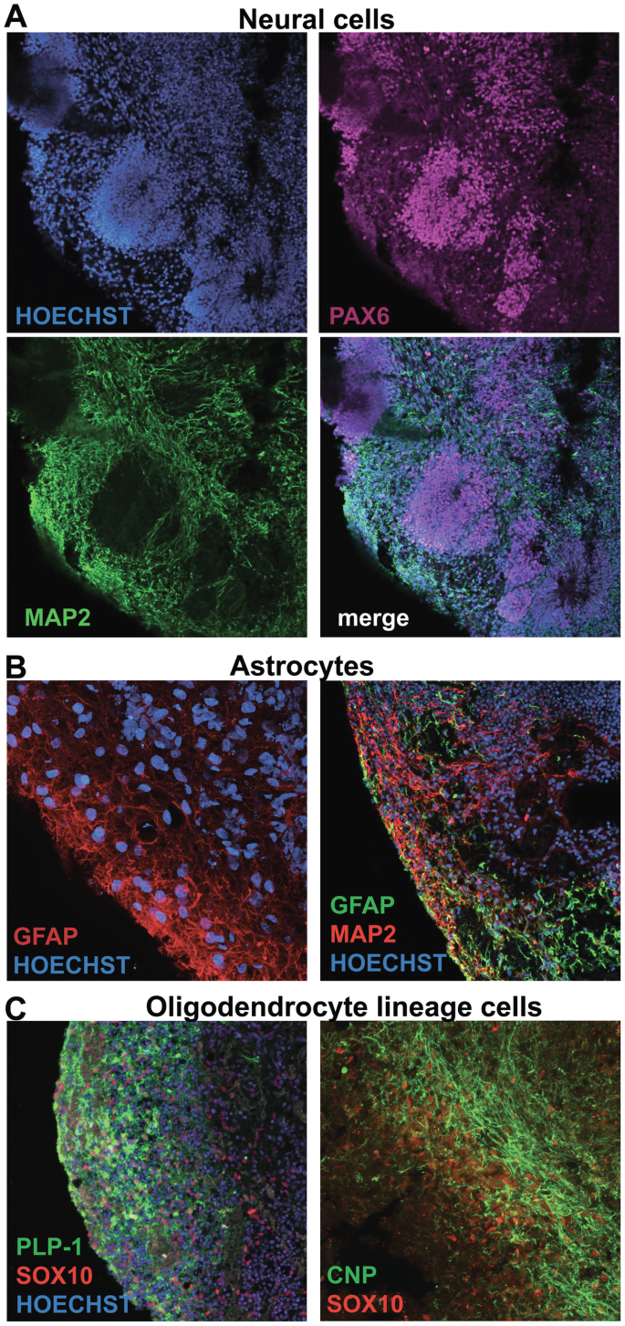 Generating Neuroimmune Assembloids Using Human Induced Pluripotent Stem ...