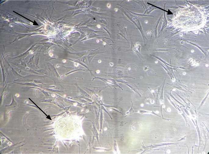 Rat Ductal Cell–Derived Differentiation into Islet-Like Cells ...