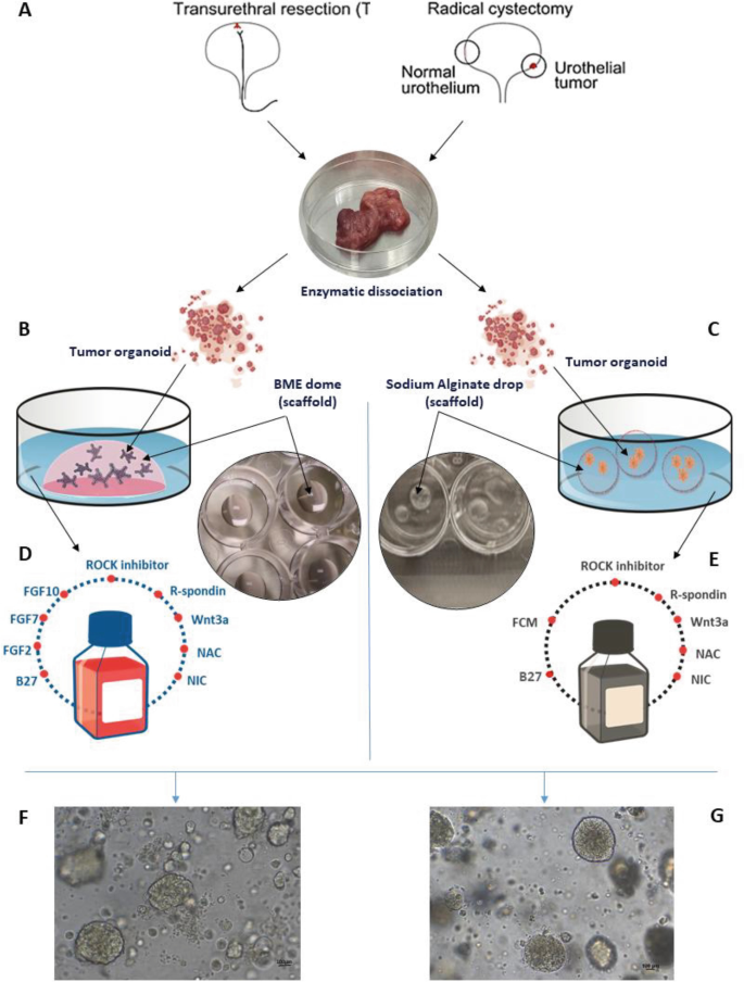 Patient-Derived Bladder Tumor Organoids Isolation and Culture ...