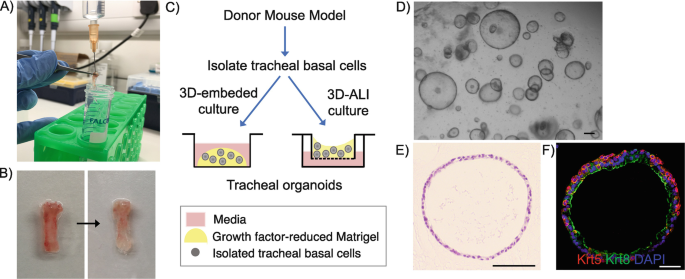 Isolation, Culture, and Phenotypic Analysis of Murine Lung Organoids ...