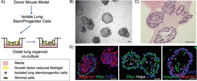 Isolation, Culture, and Phenotypic Analysis of Murine Lung Organoids ...
