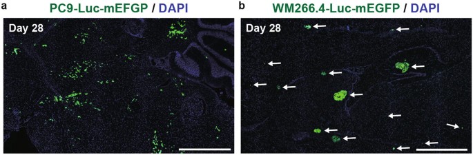 Intracardiac Injection Mouse Model to Study Cancer Cell Dormancy in ...