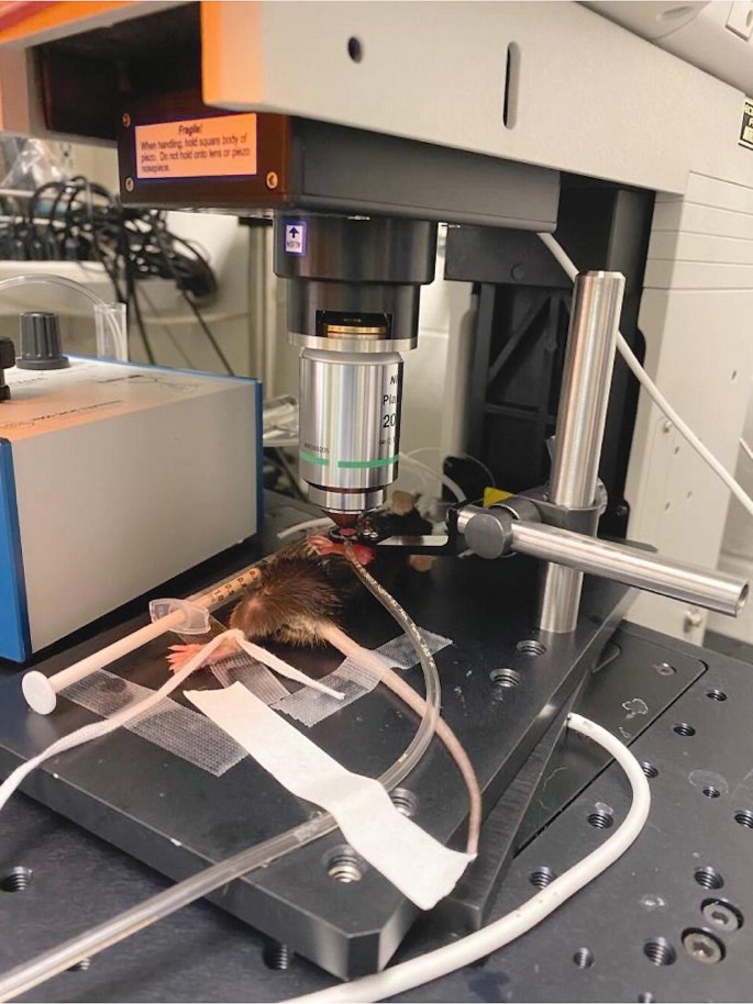 Intravital Microscopy for Imaging and Live Cell Tracking of Alveolar ...