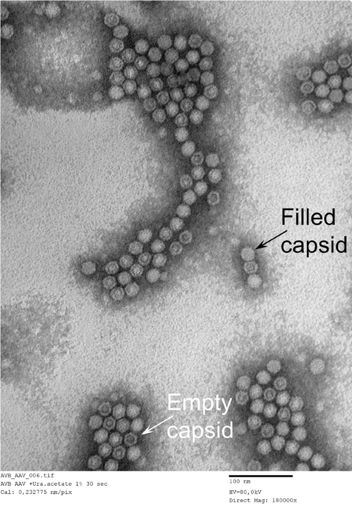 Recombinant AAV Purification | SpringerLink