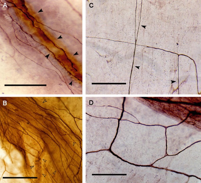 Length Measurement of Cholinergic Innervation in the Tunica Albuginea ...