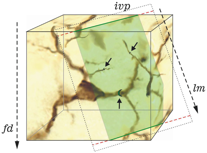 Stereological Approaches to Microglia Morphometry | SpringerLink