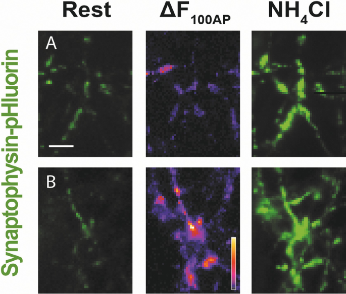 pHluorins: A Versatile Tool for the Study of Vesicle Biology | SpringerLink