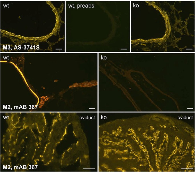 Use of Antibodies in the Research on Muscarinic Receptor Subtypes ...