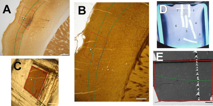 3D Quantitative Analysis of Synaptic Ultrastructure in Identified Long ...