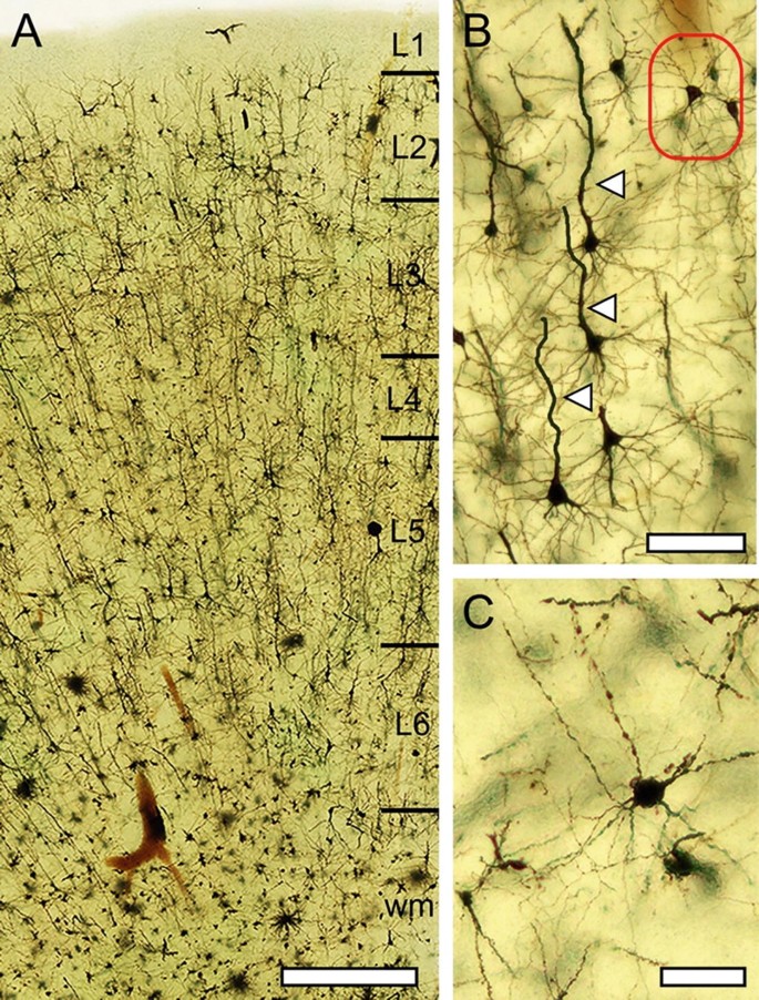 Quantitative Analysis of the Synaptic Organization of the Human ...