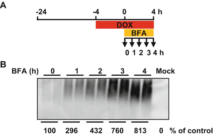 A Particle Gel Assay for Detection of Intracellular Hepatitis B Virus ...