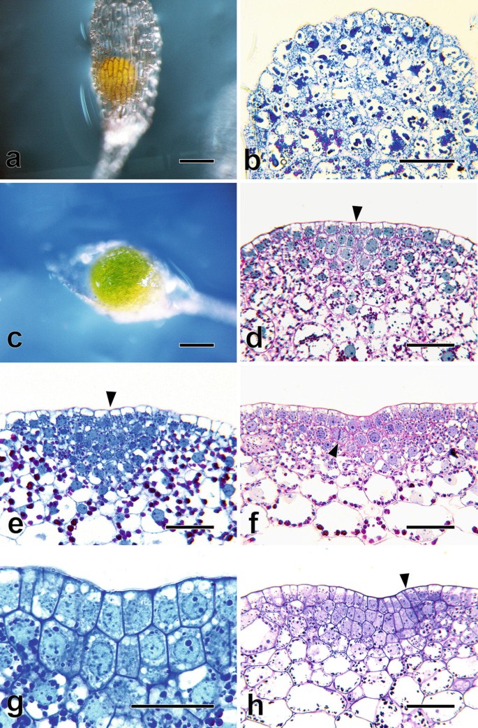 Asymbiotic Protocorm Morphogenesis | SpringerLink