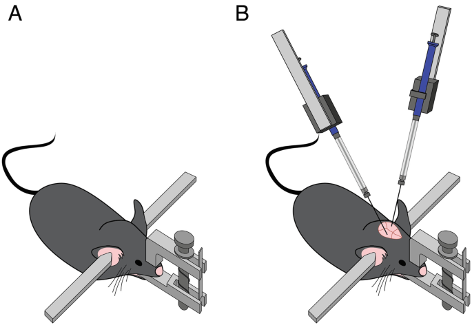 Stereotaxic Surgery as a Method to Deliver Epigenetic Editing ...