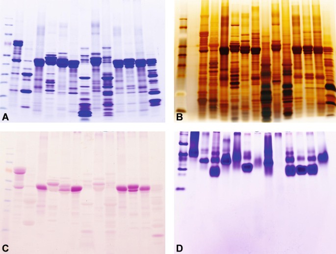 Polyacrylamide Gel Electrophoresis | SpringerLink