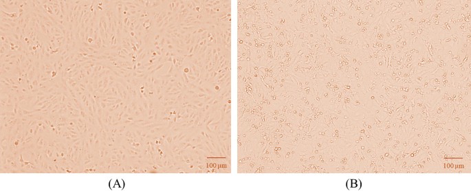Experimental Infection of Ticks with SFTSV | Springer Nature Link ...