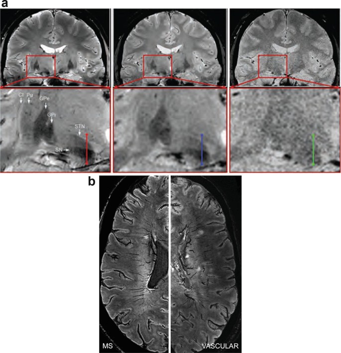 High-Field fMRI | SpringerLink