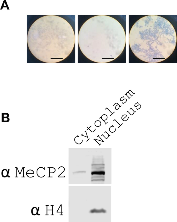 RNA Immunoprecipitation (RIP) from Purified Nuclei in Cells | SpringerLink