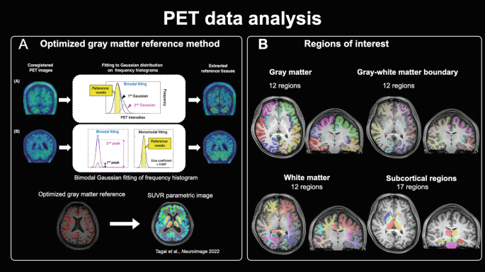PET Visualization of Brain Tau Accumulations Secondary to Various CNS ...