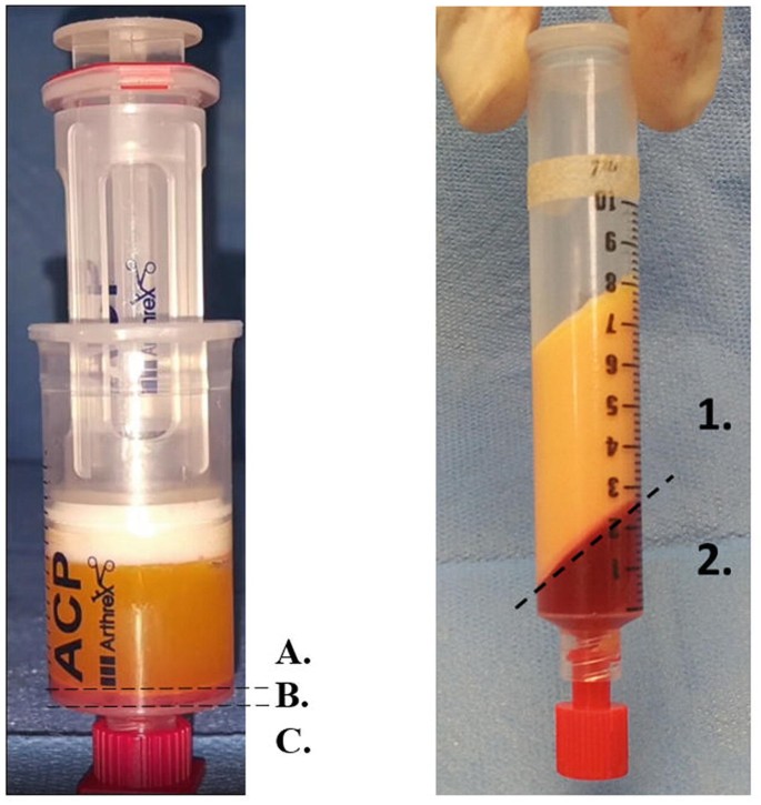 Isolation of Stromal Vascular Fraction by Fractionation of Adipose ...