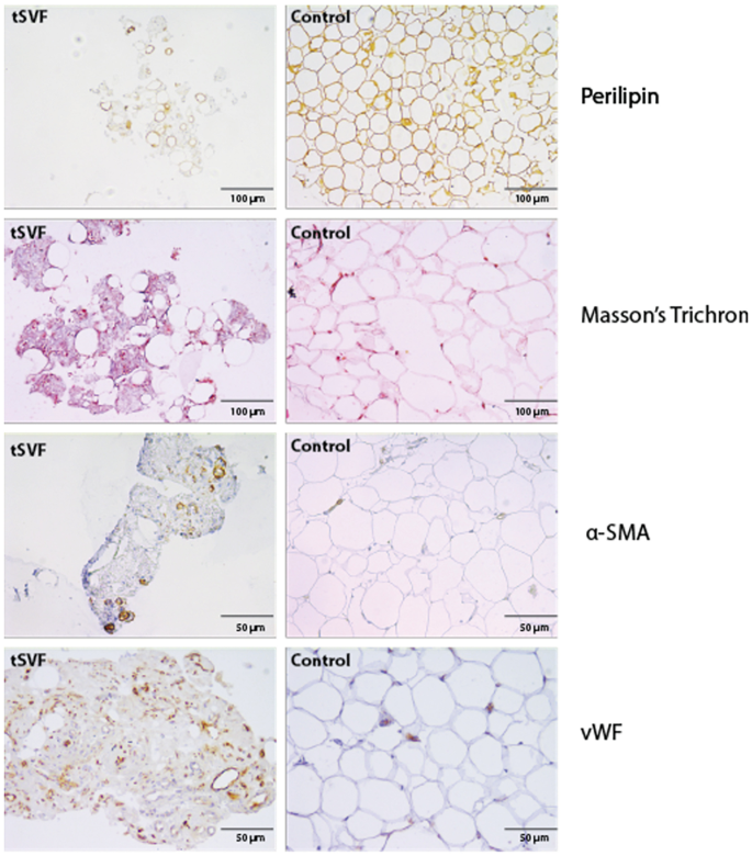 Isolation of Stromal Vascular Fraction by Fractionation of Adipose ...