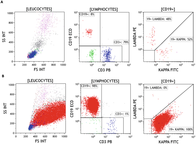 Cytomorphology and Flow Cytometry of Brain Biopsy Rinse Fluid ...