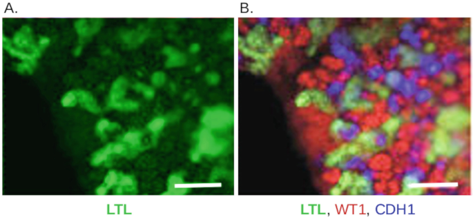 Toxicity Testing Using Organoids Made from Human-Induced Pluripotent ...